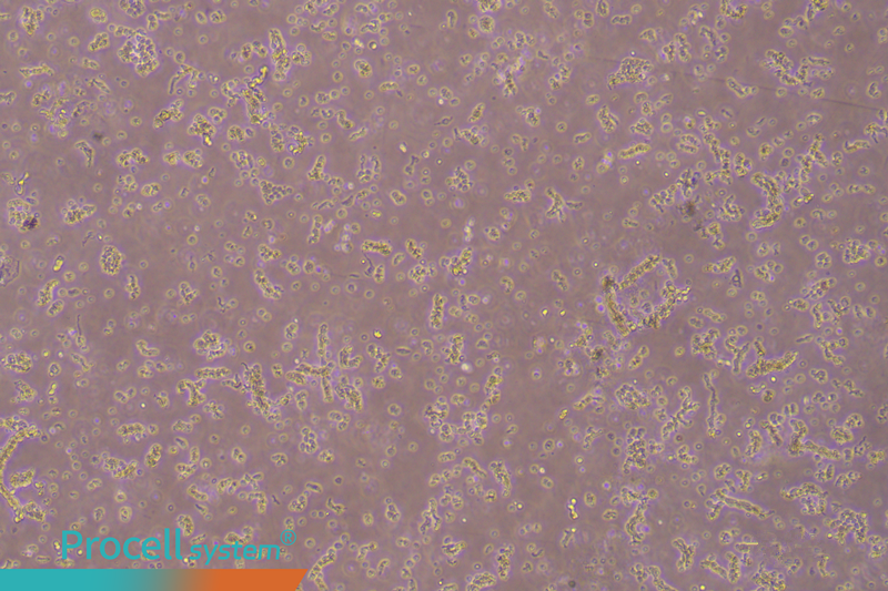 Cardiac Endothelial Cell Isolation Keeps Failing? Copy This High-purity ...