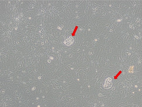 Common Types of Cell Culture Contamination